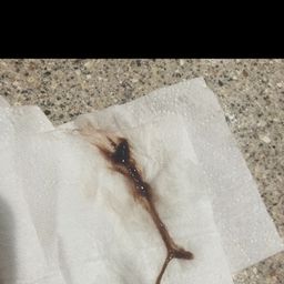 Implantation Bleeding Brown Stringy Discharge