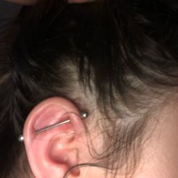 Ear Piercings Industrial Infected